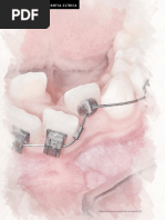 Curva de Spee e Wilson | PDF | Ortodontia | Dente