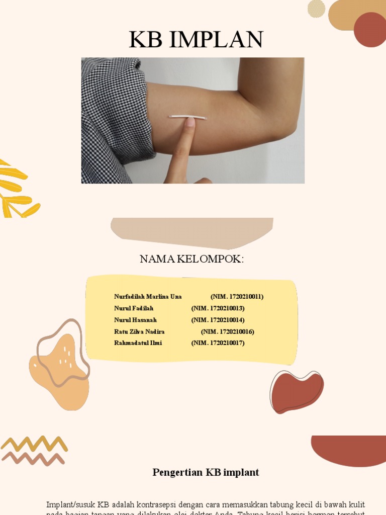 KB Implan | PDF