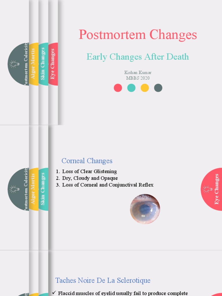 PM Changes | Download Free PDF | Human Eye | Ophthalmology
