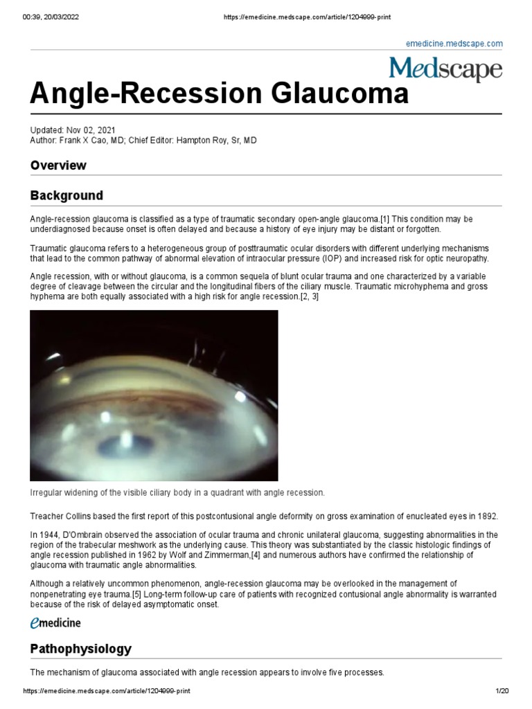 Angle Recession Glaucoma | PDF