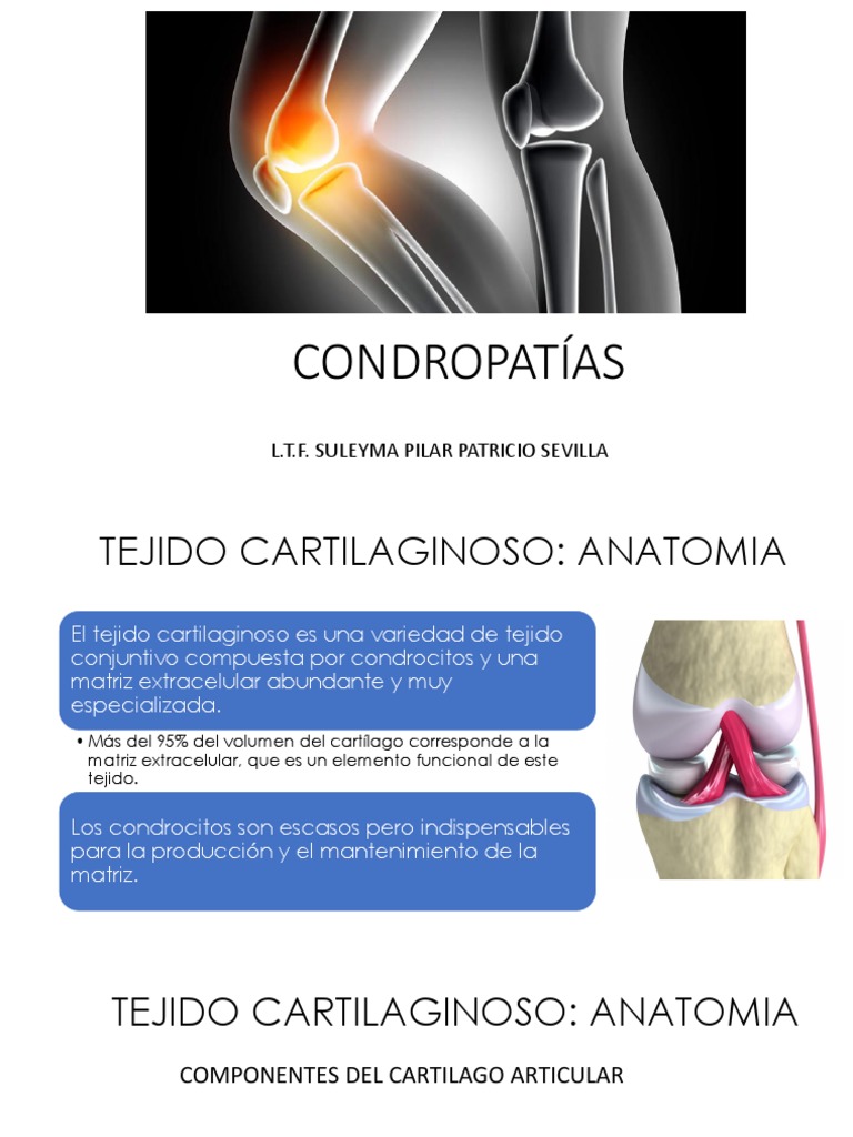 CONDROPATÍAS-FISIOTERAPIA | PDF | Cartílago | Rodilla