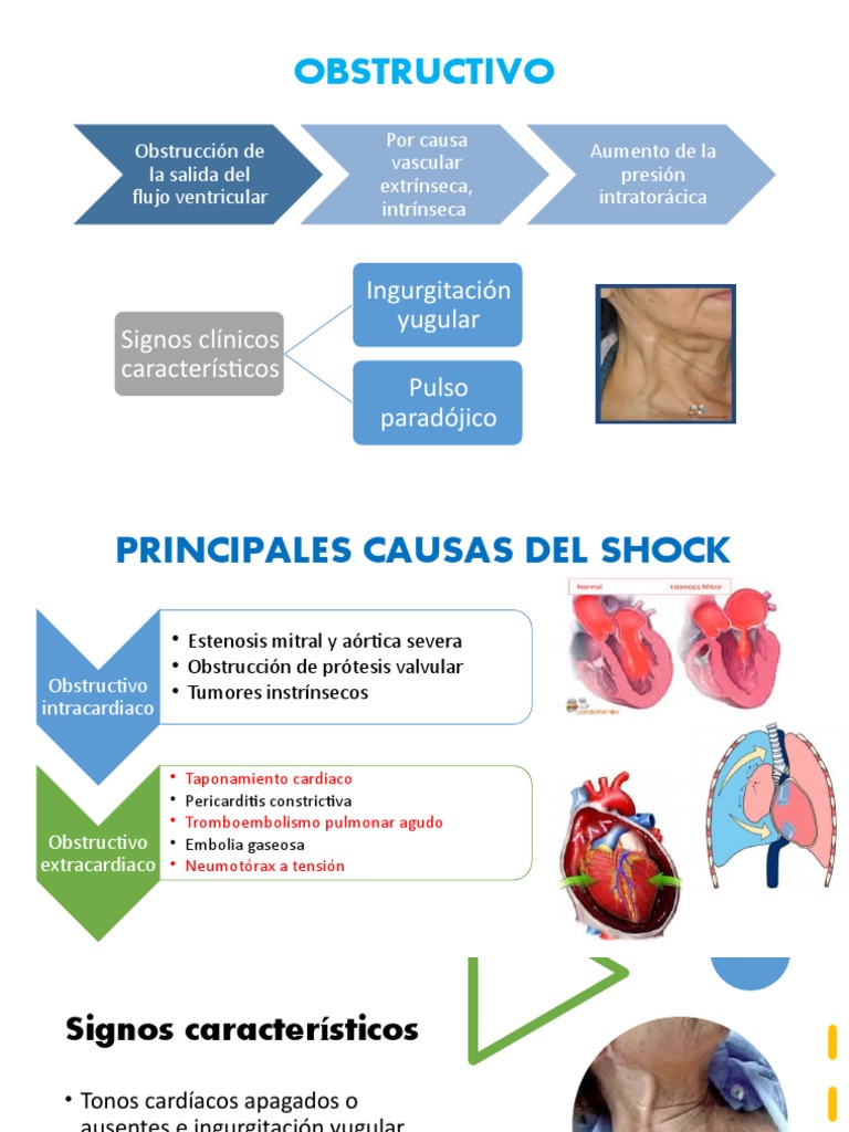 Obstructivo: Signos Clínicos Característicos Ingurgitación Yugular ...