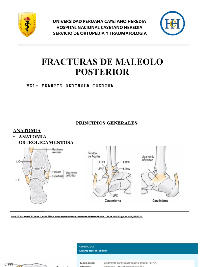 Maleolo Posterior | PDF