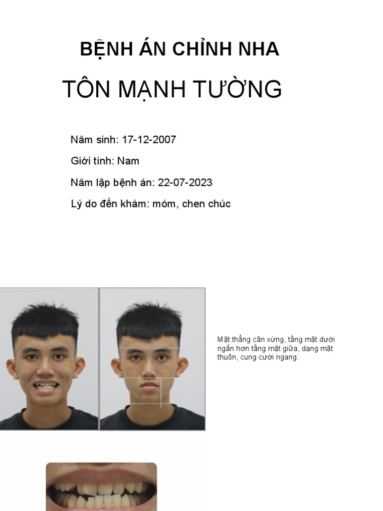 Tôn M NH Tư NG | PDF