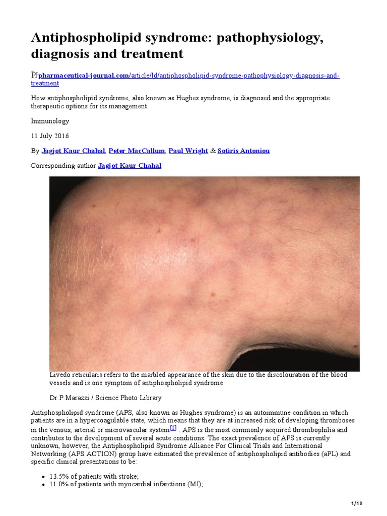 Antiphospholipid Syndrome Pathophysiology Diagnosis and Treatment | PDF