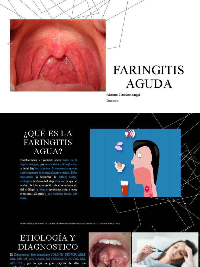 Faringitis Aguda | PDF | Relaciones personales, crianza y desarrollo ...