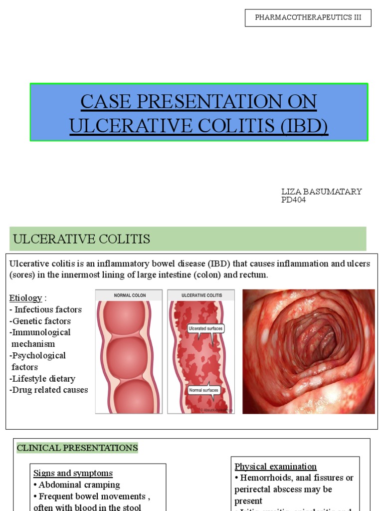 Case Presentation On Ulcerative Colitis (Ibd) (Exp.3) (Liza) | PDF
