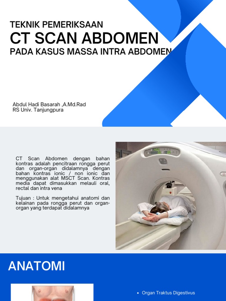 Hadi - Teknik Pemeriksaan CT Scan Abdomen Pada Kasus Massa Intra Abdomen | PDF