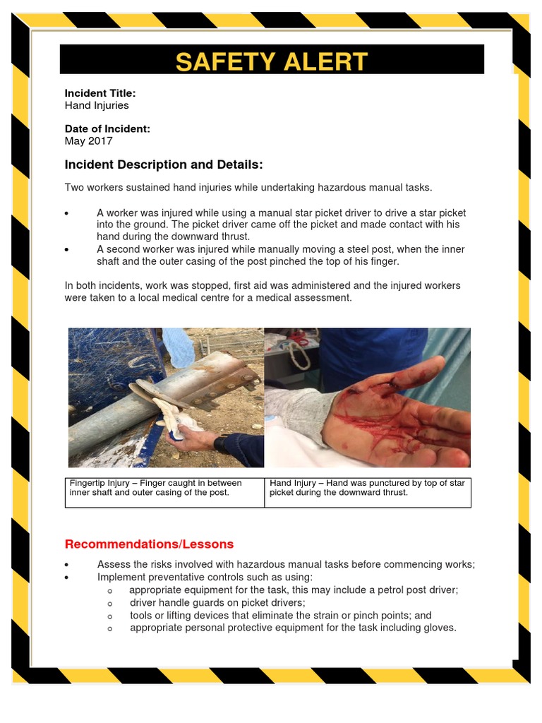 Safety Alert Hand Injury | PDF