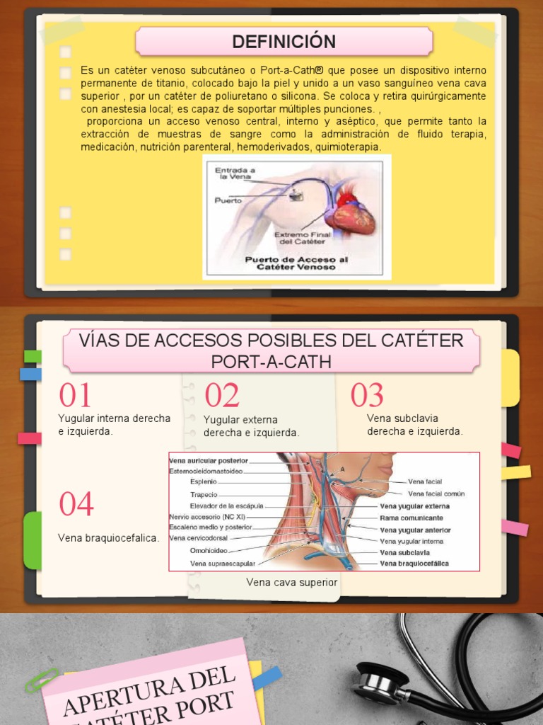 Cateter Port | PDF