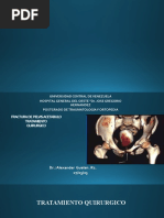 Fracturas de Cotilo | PDF | Pelvis | Sistema esquelético