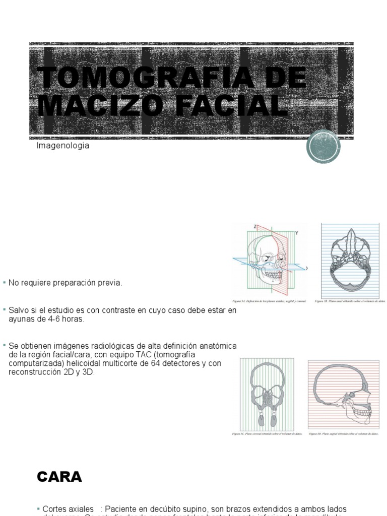 Tomografia de Macizo Facial | PDF | Imagenes medicas | Ct Scan
