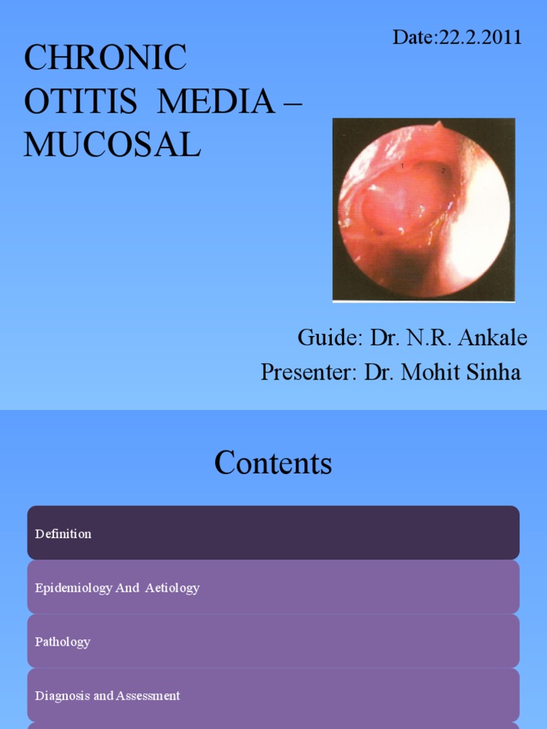 Mucosal Chronic Otitis Media Overview | PDF | Epithelium | Clinical ...