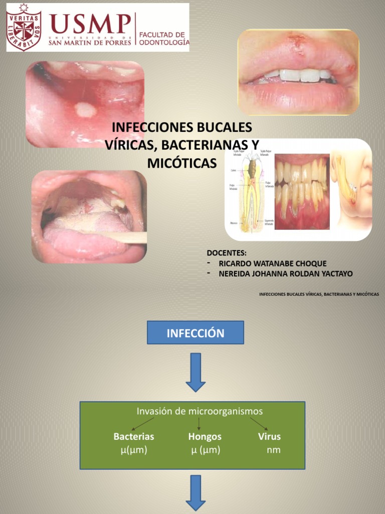 Infecciones Bucales Viricas, Bacterianas y Micoticas N.2 | PDF