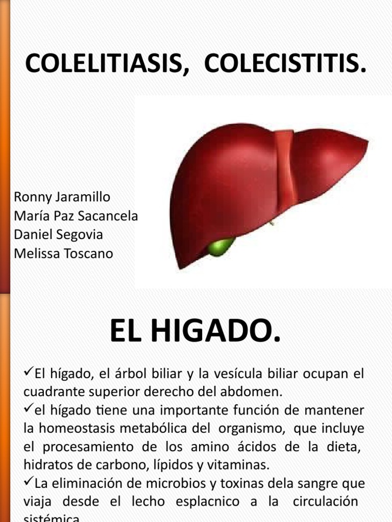 Colelitiasis | PDF | Bilis | Vesícula biliar