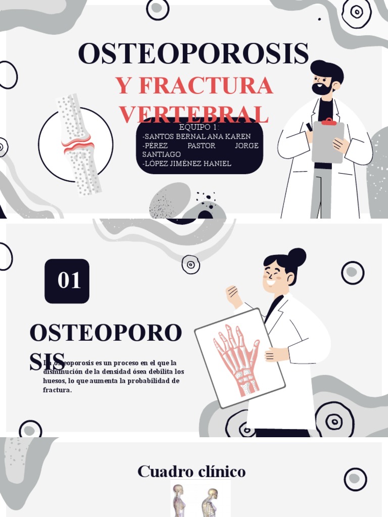 Osteoporosis y Fractura Vertebral | PDF