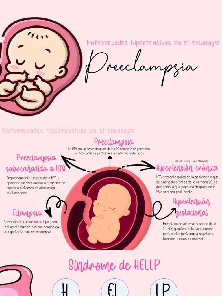 Preclampsia. Ferchis | PDF | Hipertensión | El embarazo