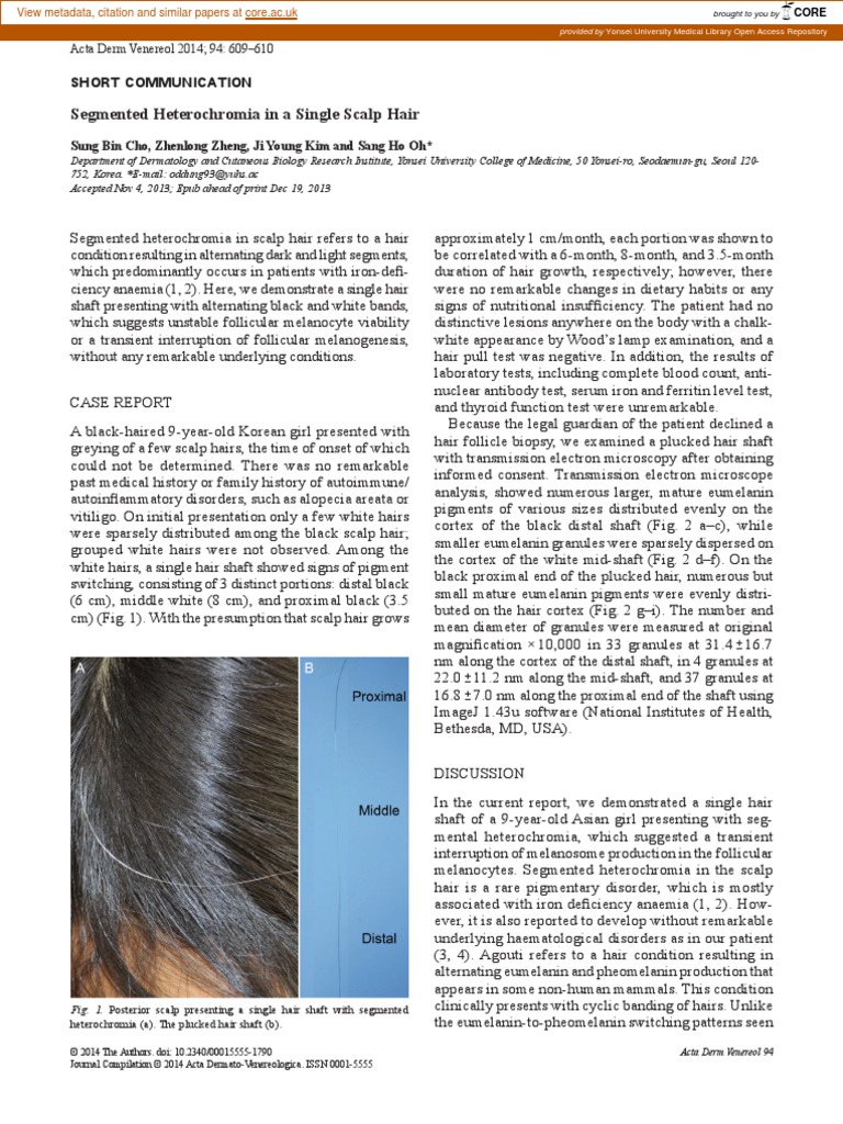 Segmented Heterochromia in A Single Scalp Hair: Short Communication ...