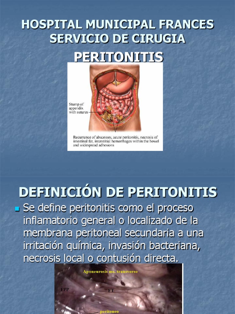 Peritonitis | PDF | Medicina | Ciencias de la Salud