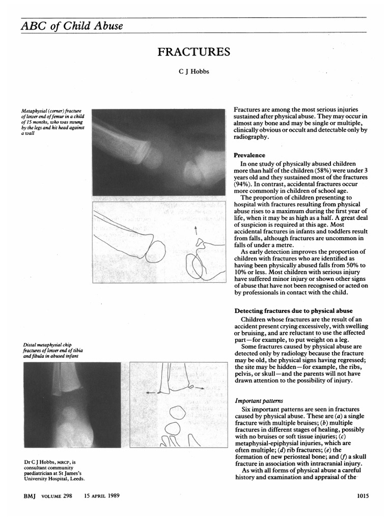 ABC of Child Abuse. Fractures. | PDF