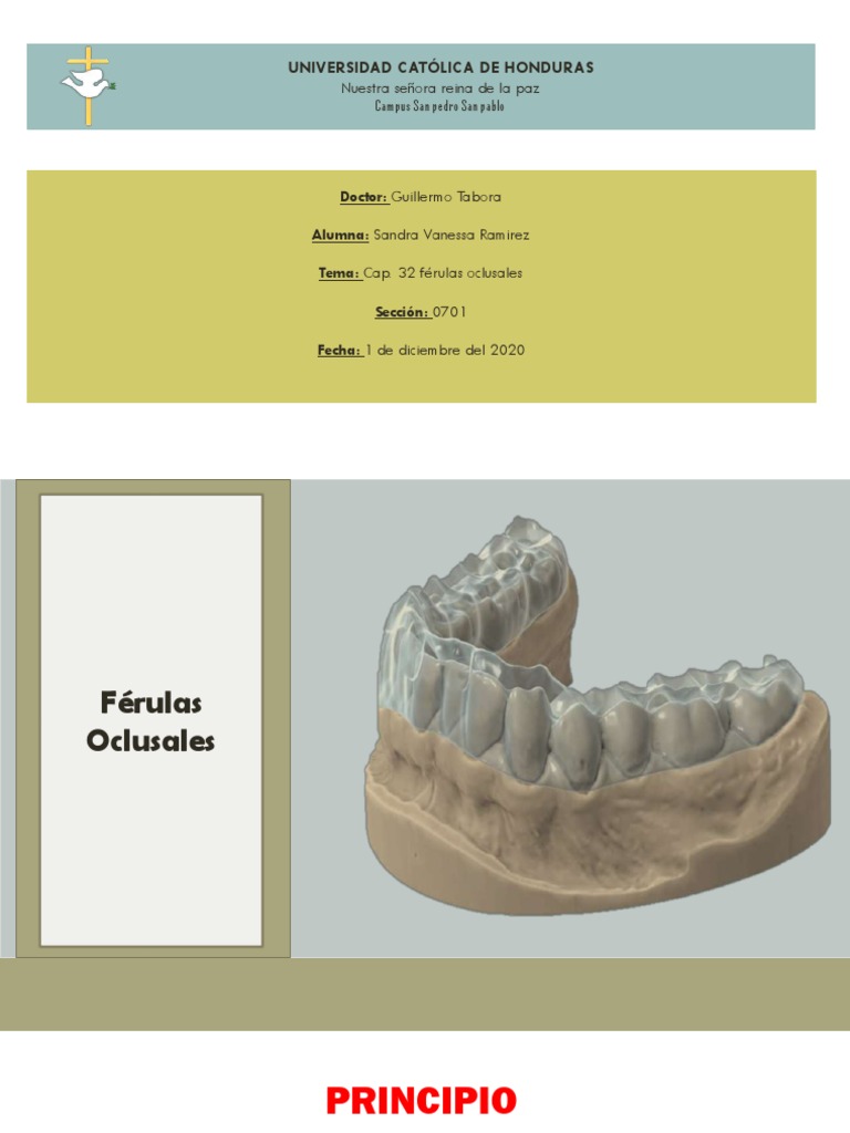 Férulas Oclusales: Tipos y Funciones | PDF