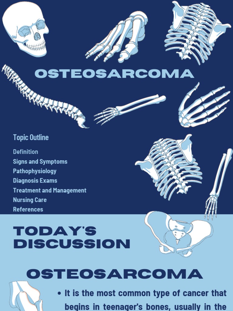 Understanding Osteosarcoma: Overview | PDF