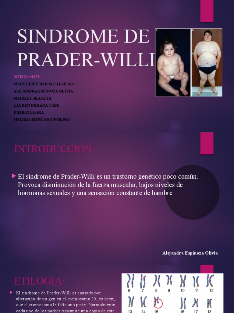Sindrome de Prader-Willi - Embriologia | PDF