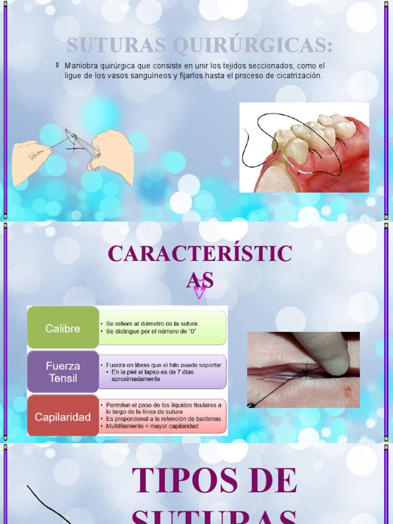 Grupo 5. Suturas | Descargar gratis PDF | Sutura Quirúrgica | Cirugía
