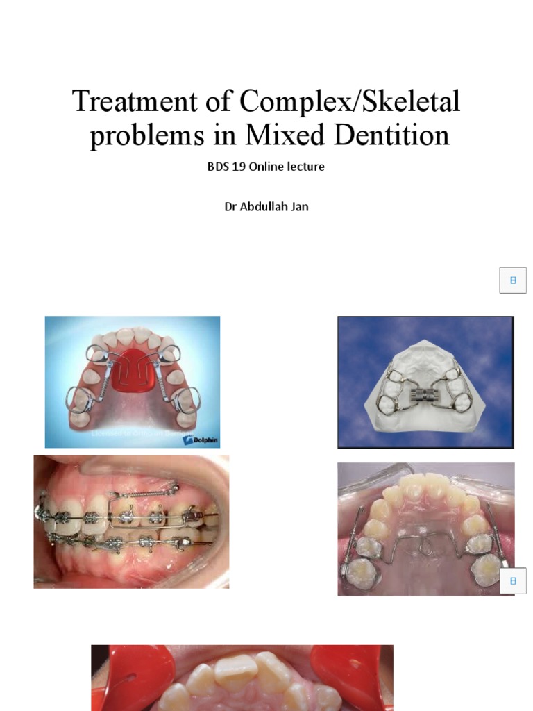 Traetment Planning in Mixed Dentition 4 | PDF | Dentistry Branches ...