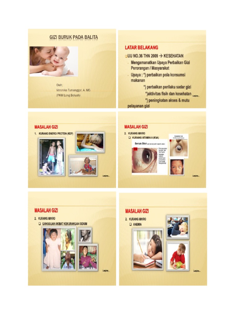 MATERI GIZI BURUK PRINT | PDF