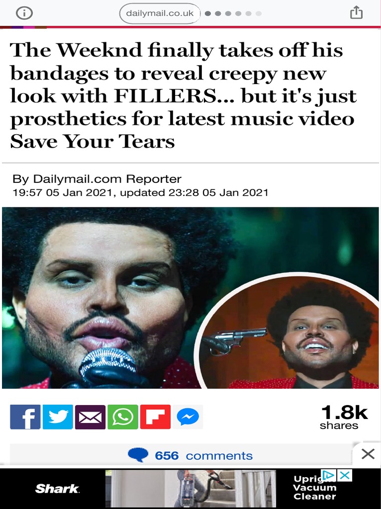 The Weeknd Has Extreme Botox Look in Save Your Tears Music Video | PDF