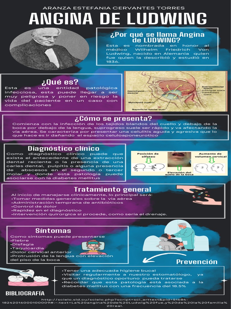 Angina de LUDWING, Aranza Cervantes | PDF | Ciencia y matemáticas