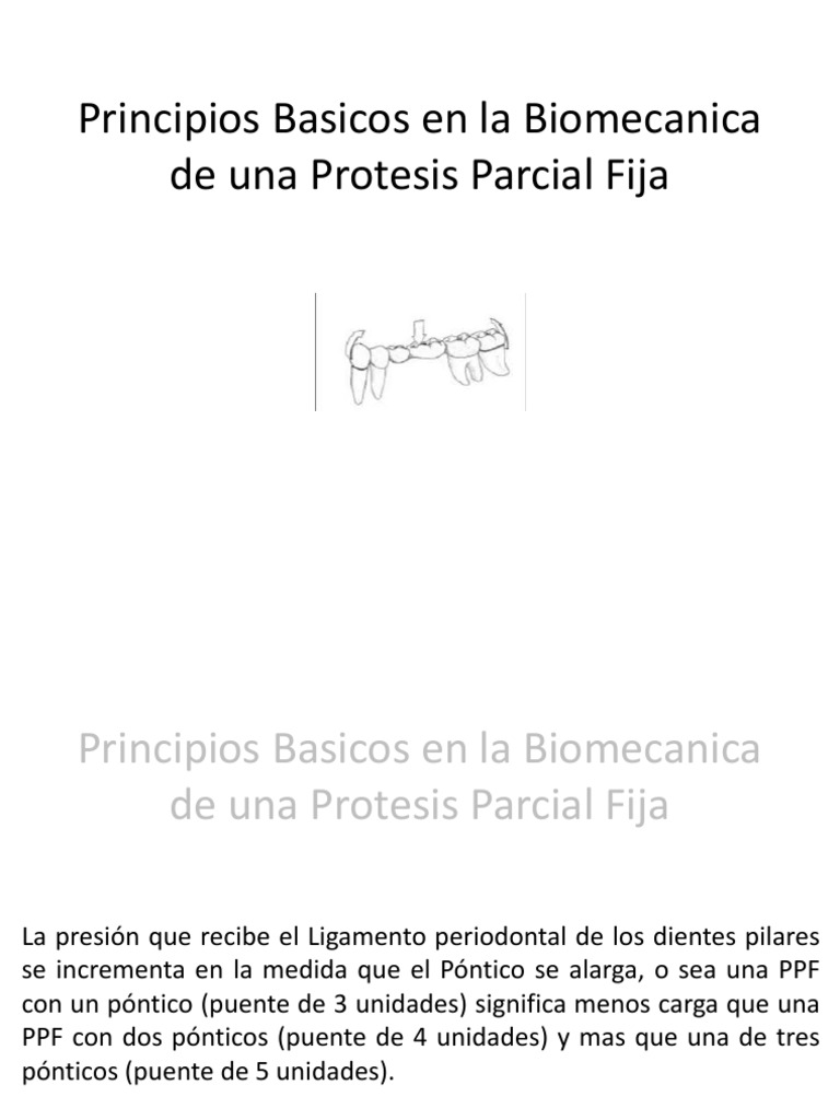 1.6.2 Principios Basicos en La Biomecanica de Una PPF | PDF