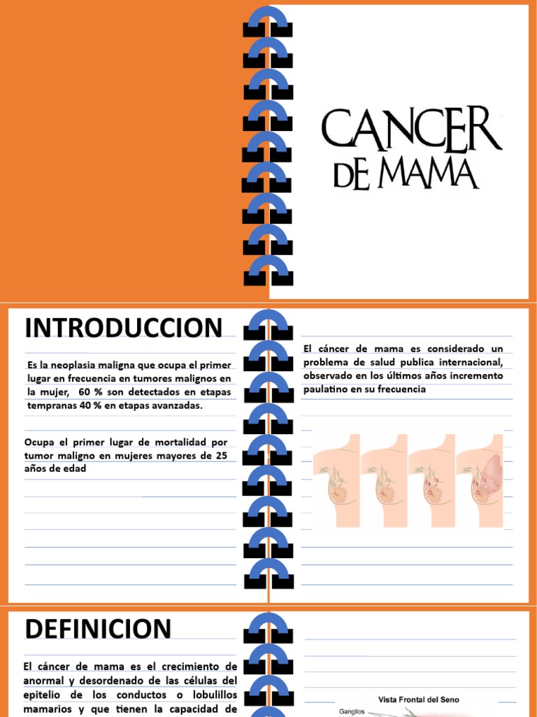CANCER DE MAMA | PDF | Cáncer de mama | Cáncer