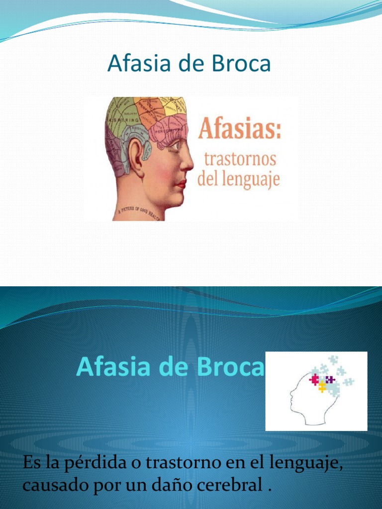 Afasia de Broca | PDF | Afasia | Medicina