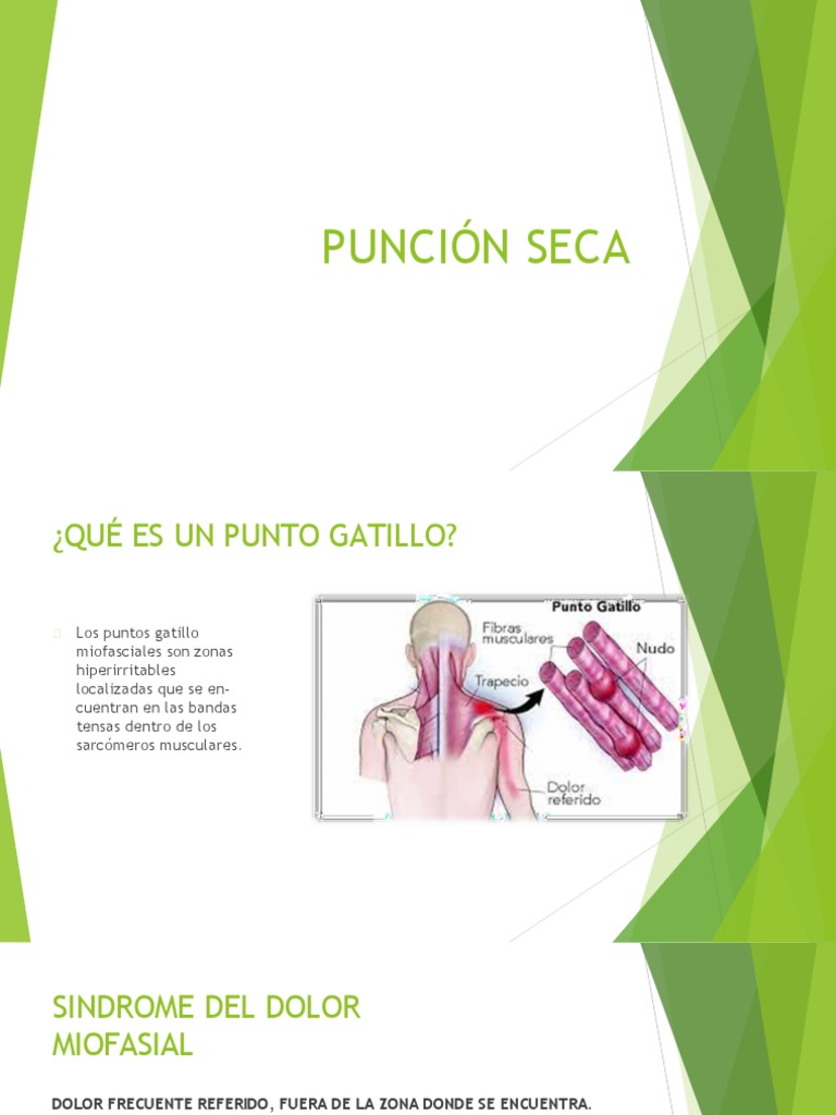 Punción Seca | PDF