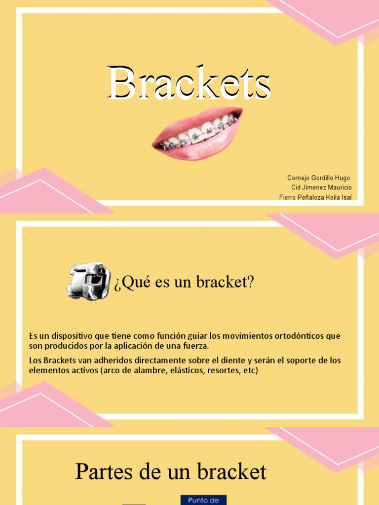 Partes y Clasificación de Brackets | PDF | Ortodoncia | Ramas de ...