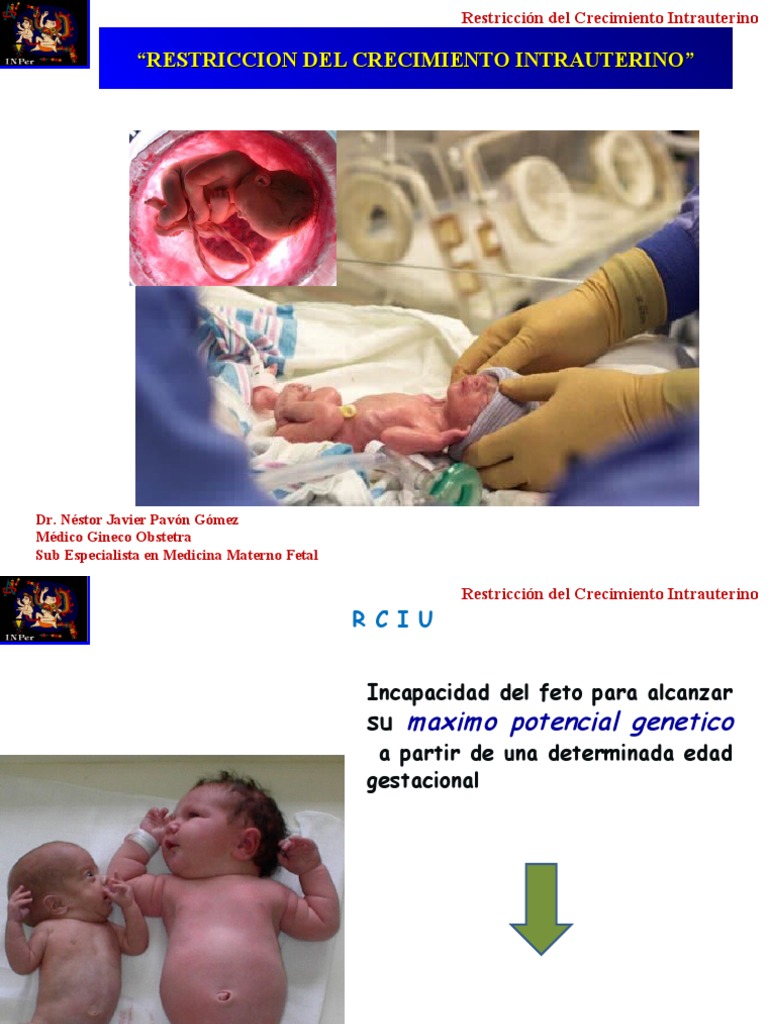 Rciu | PDF | Placenta | Feto