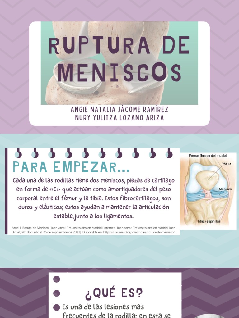 Ruptura de meniscos. | PDF