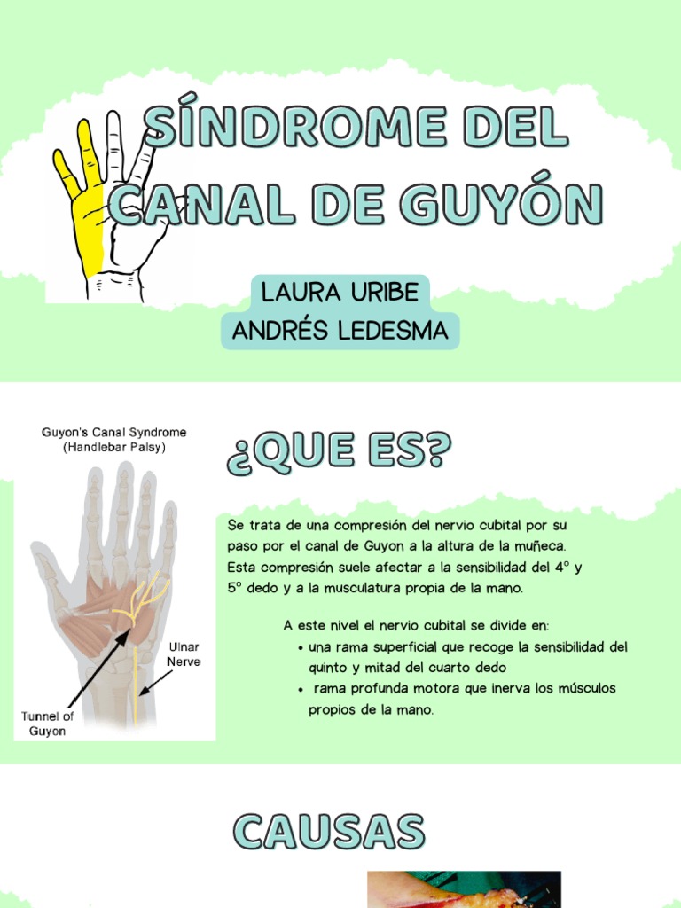 Síndrome Del Canal de Guyón | PDF