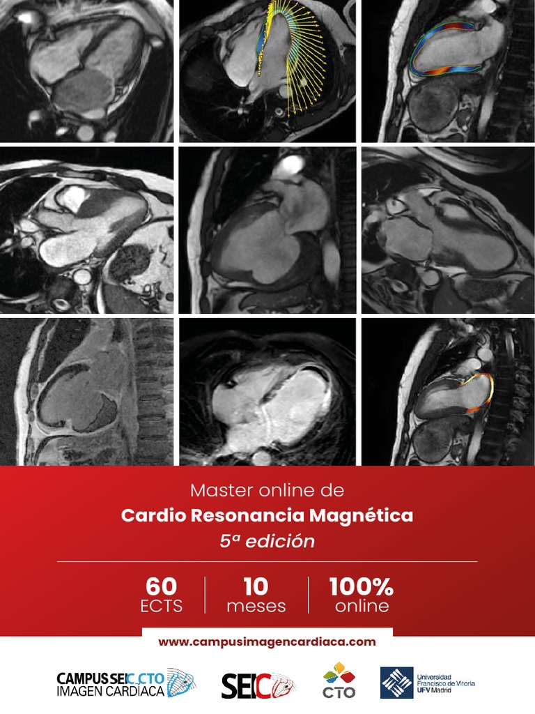 Máster Online en Cardio RMN 2023 | PDF
