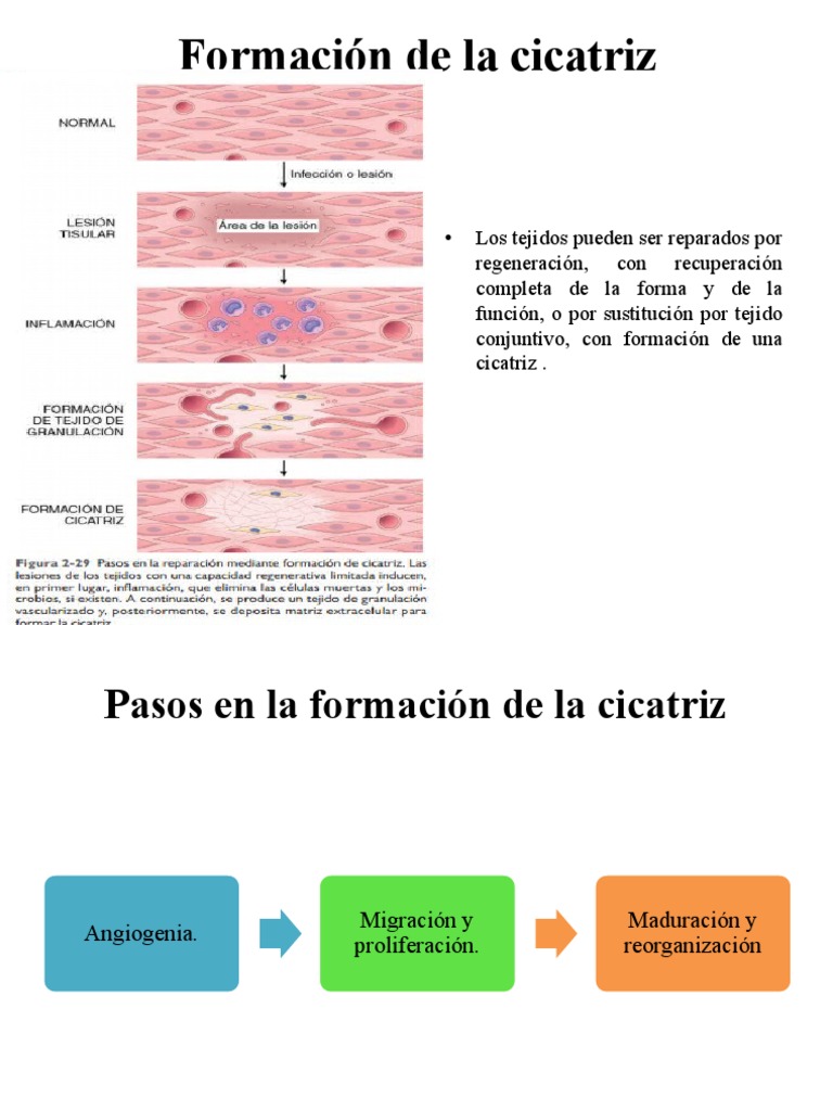 Formación de La Cicatriz | PDF