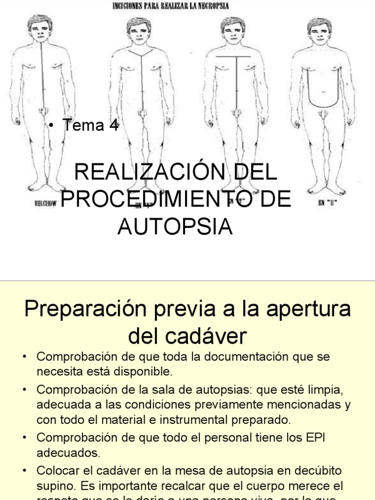 T4 Realizacion Del Procedimiento de Autopsia v1 | PDF
