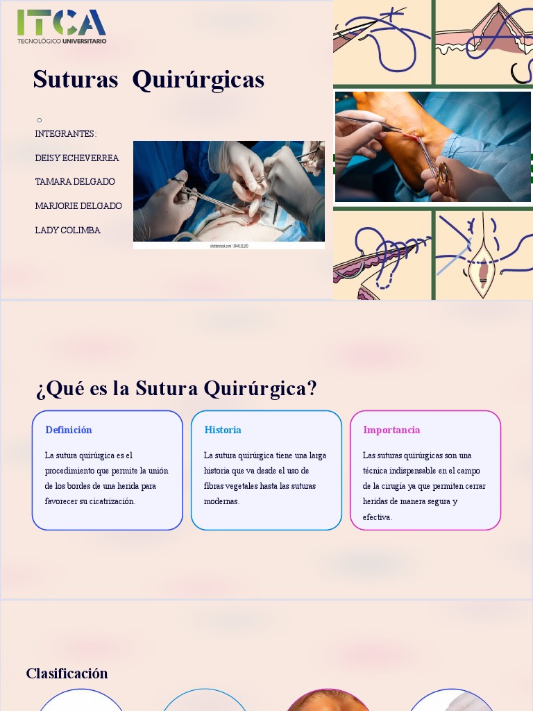 Suturas Quirurgicas | PDF