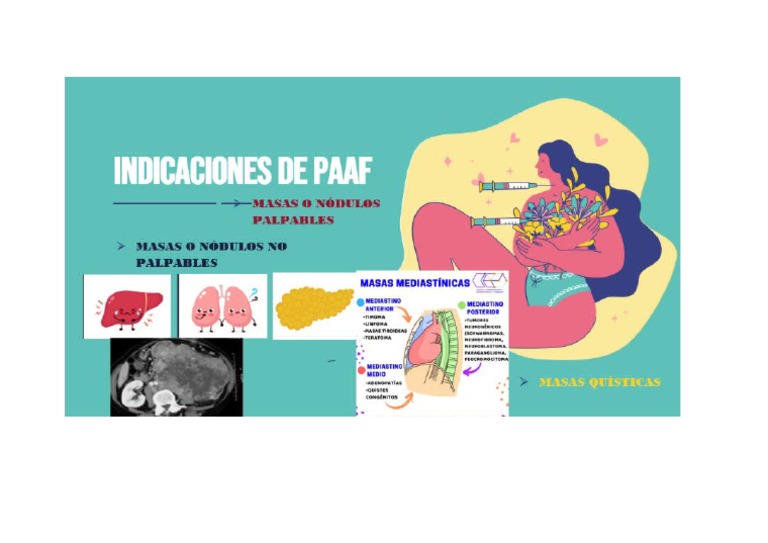 Indicaciones de Paaf | PDF