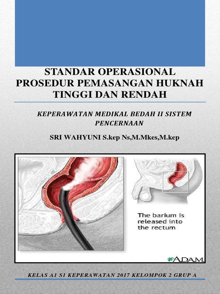 toaz.info-standar-operasional-prosedur-pemasangan-huknah-tinggi-dan ...
