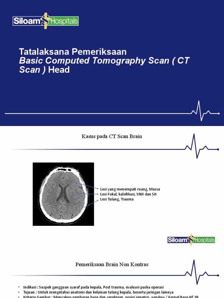 Tatalaksana Pemeriksaan CT Brain | PDF