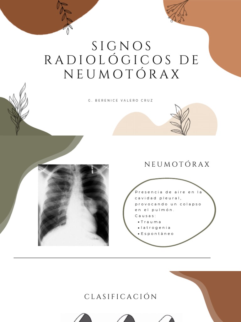 Neumotórax Signos Radiológicos | PDF