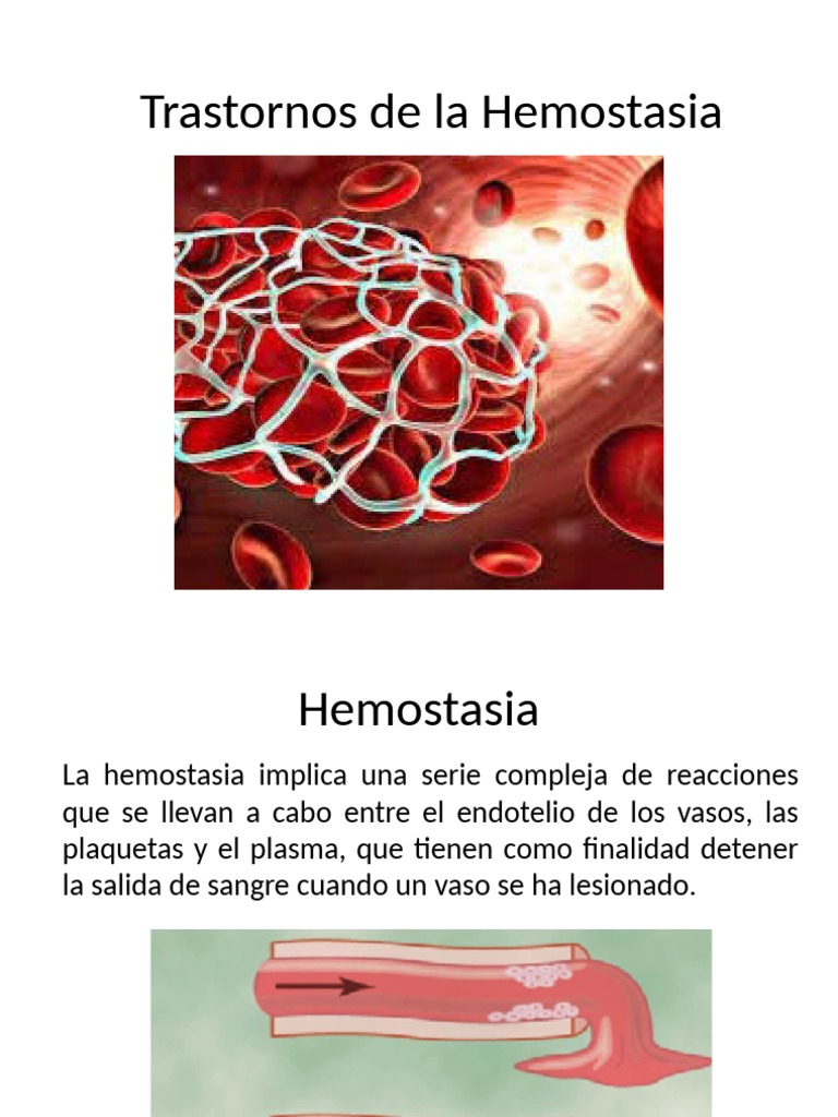 Trastornos de La Hemostasia | PDF | Hemostasia | Plaqueta