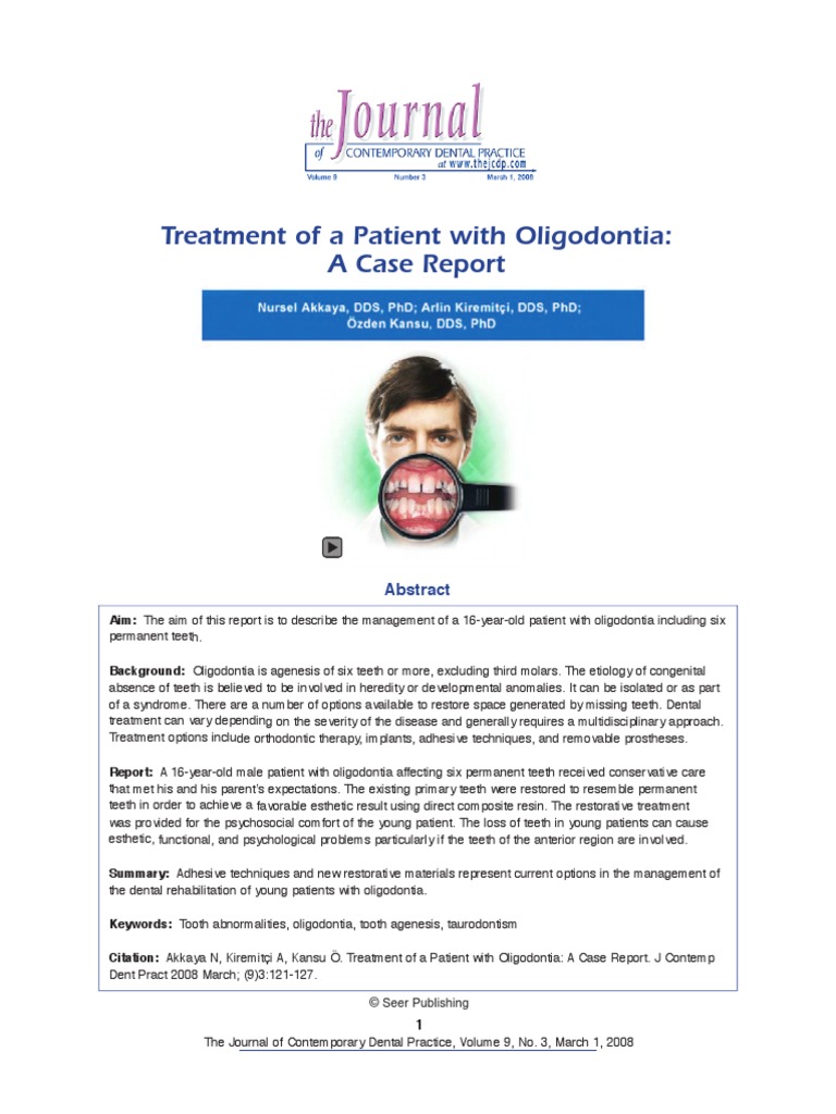 Treatment of A Patient With Oligodontia A Case Report | PDF | Dental Implant | Clinical Medicine